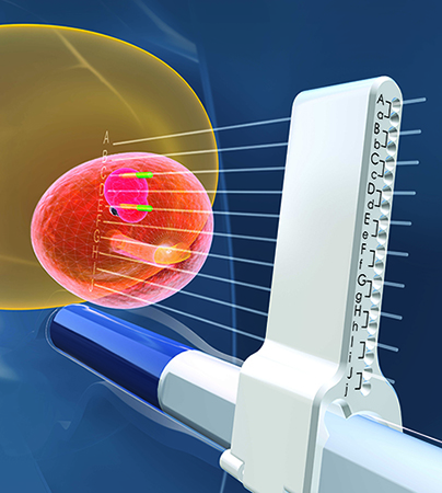 Your match – Treatment (Physician) - Site diagnostic